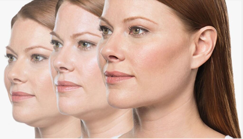 Fat Dissolving - Maria Beauty Clinic